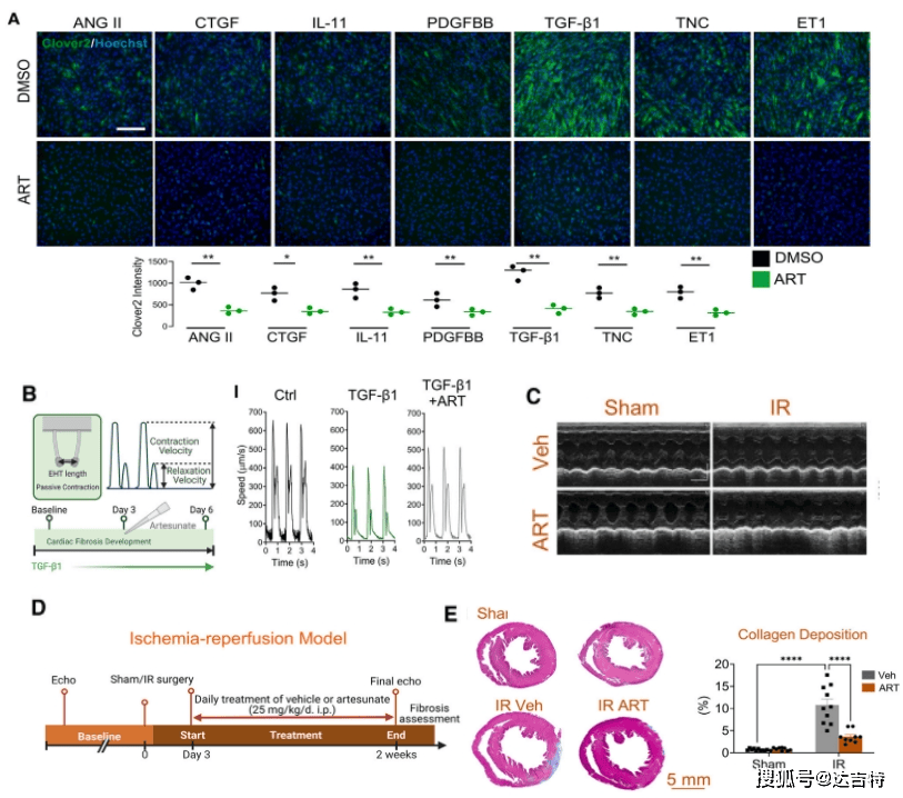 重磅｜青蒿琥酯ART靶向MD2蛋白刚刚登上Cell杂志_心脏_研究_MyoFB
