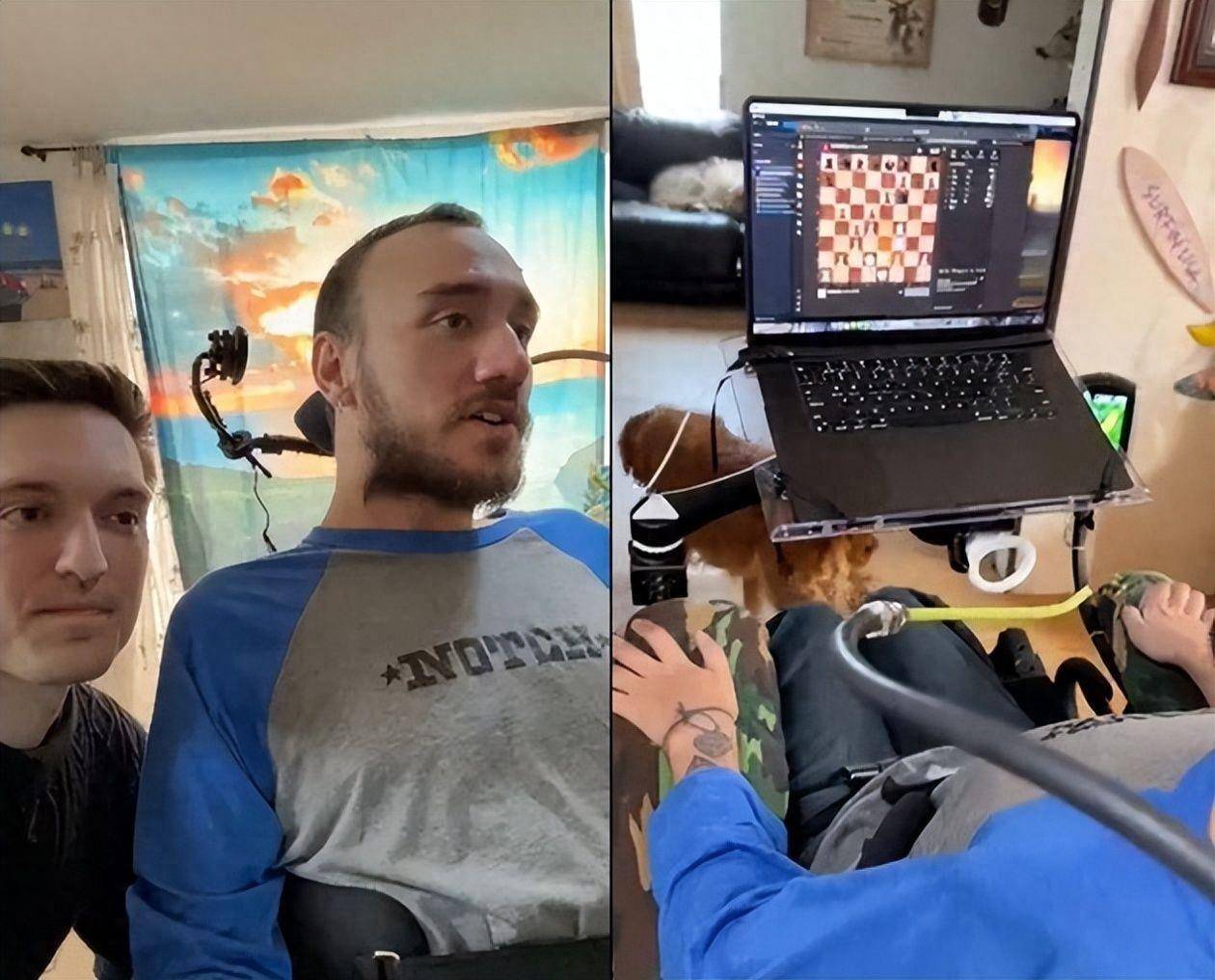 Neuralink首位患者演示：思想控制计算机成现实_诺兰·阿博_技术_视频